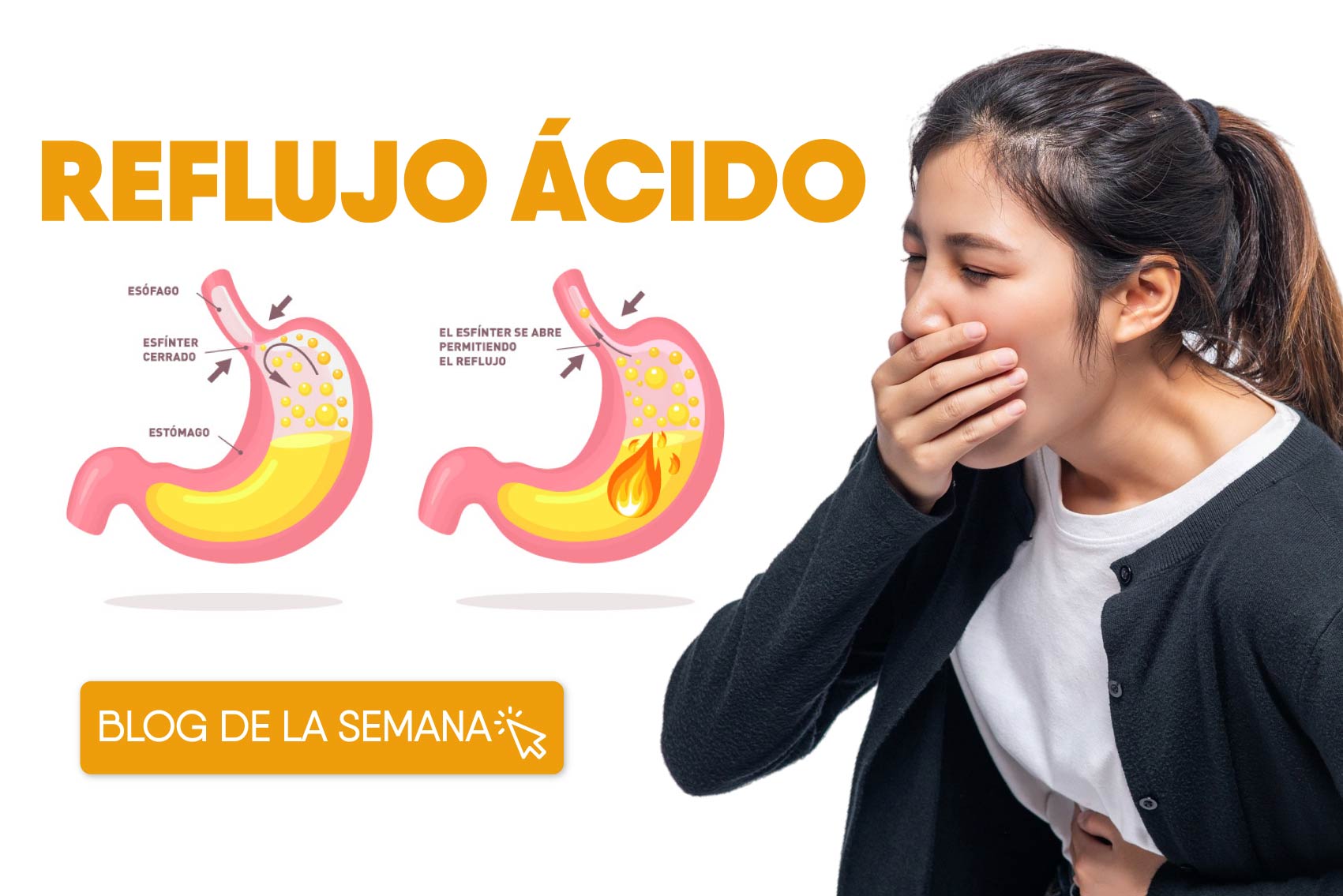 Cómo prevenir el reflujo ácido | Centro Médico Daniel Alcides Carrión